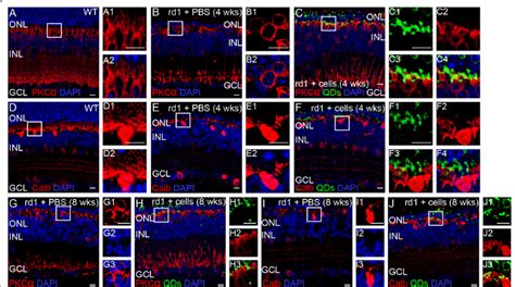 Morphological Modifications In The Inner Retina Of The Rd1 Mice After Download Scientific