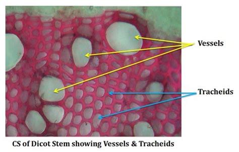 Tracheids In Roots