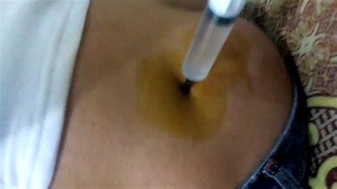 Beautiful Girl Sitting Down To Get A Butt Shot Injectio