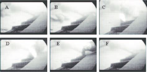 —photographic Sequence Of A Loggerhead Sea Turtle Carcass Encountering Download Scientific