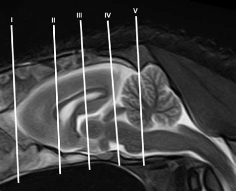 Sagital T2w Mr Image Of The Head Of The Crested Porcupine The Lines