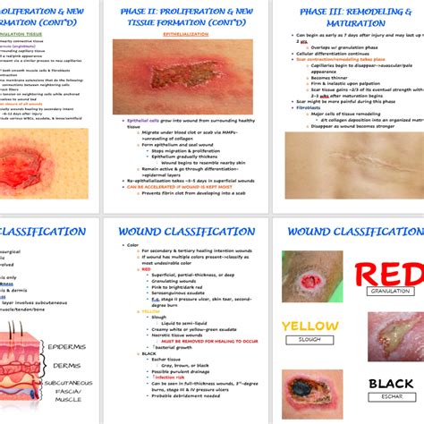 Wound Healing Nursing School Notes Etsy