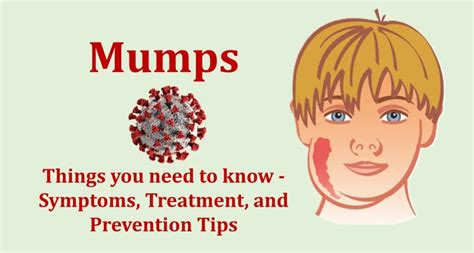 Mumps Things You Need To Know Symptoms Treatment And Prevention Tips