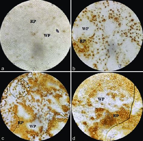 Spleen Section Showing A Isotype Control B Cd8 Cd4 Cd8