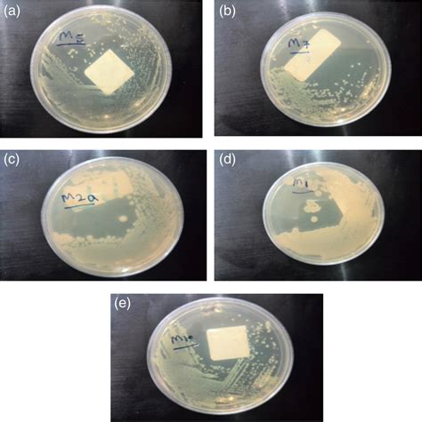Photographs Of Bacteria Identified To Degrade Ao7 Dye A Bacillus Download Scientific Diagram