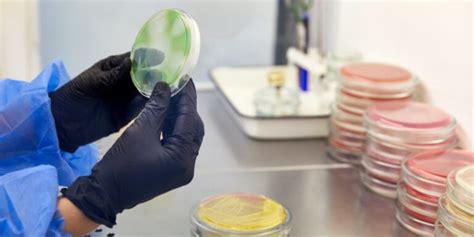 Identifying Microbes 9 Bacterial Identification Methods