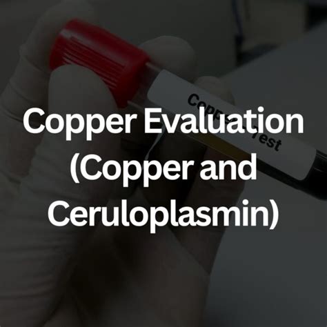 Shbg Sex Hormone Binding Globulin Mandm Labs