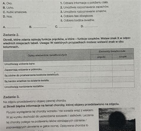 Zadanie 2 Określ które zdania opisują funkcje pręcików a które