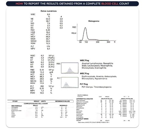 Digital Class 5 Analytic And Post Analytic Quality Control Recursos Educativos Abiertos
