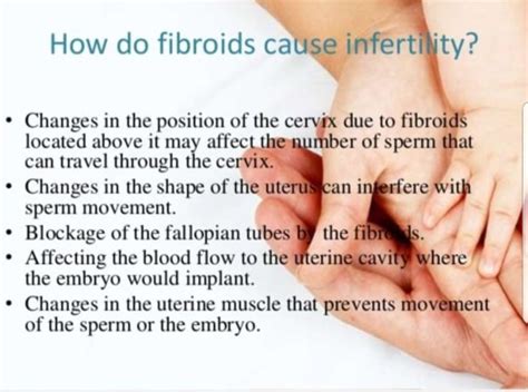 Fibroids Cause Infertility Fibroids Fallopian Tubes Infertility