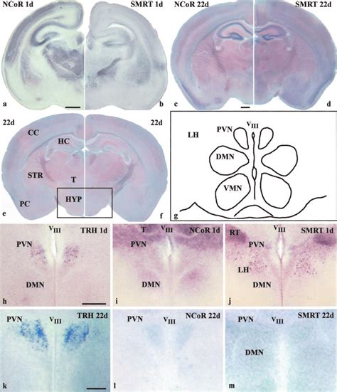 Ncor And Smrt Corepressor Mrna Expression At 1 And 22 D Postnatally In