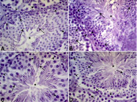 Representative Photomicrographs Pas 400x Of A Section Of Germinal
