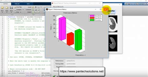 lung cancer detection using matlab
