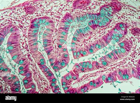 Villi Intestine Hi Res Stock Photography And Images Alamy