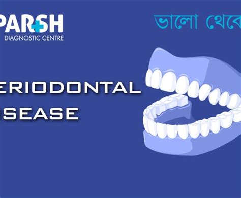 Dental Crowns Sparsh Diagnostic Center