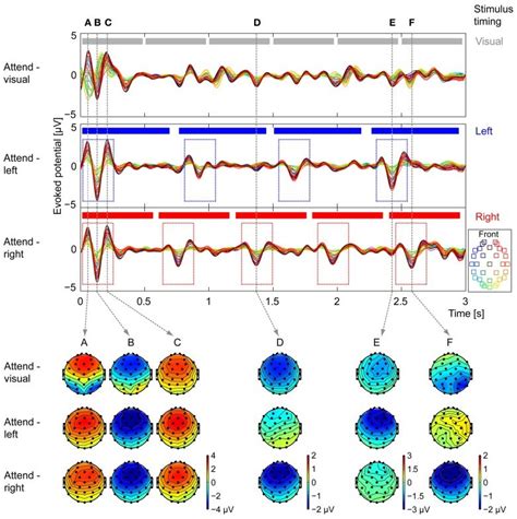 Grand Average Erp Waveforms And Topographies Average Eeg Waveforms