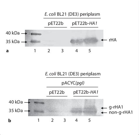 Analysis Of Periplasmic Proteins Of E Coli Bl21 De3 Overexpressing
