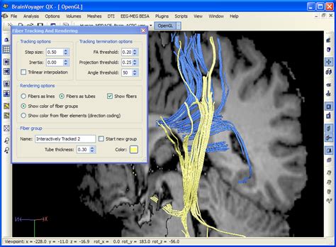 Interactive Fiber Tracking