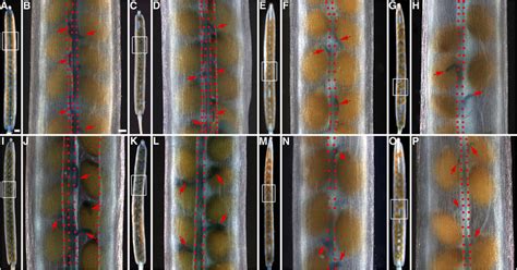 Gus Staining Patterns In Siliques Of The Gus Promoter And Gus Protein