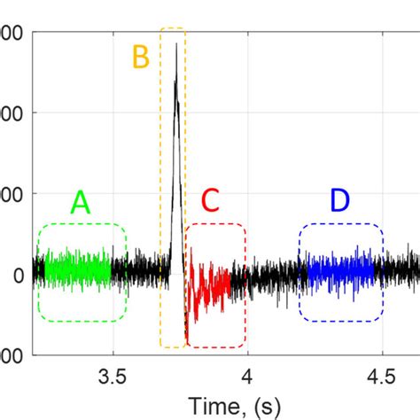 s shaped acceleration deceleration acc dec control for a signal block