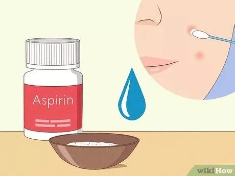 Ways To Reduce The Swelling And Redness Of Pimples Artofit