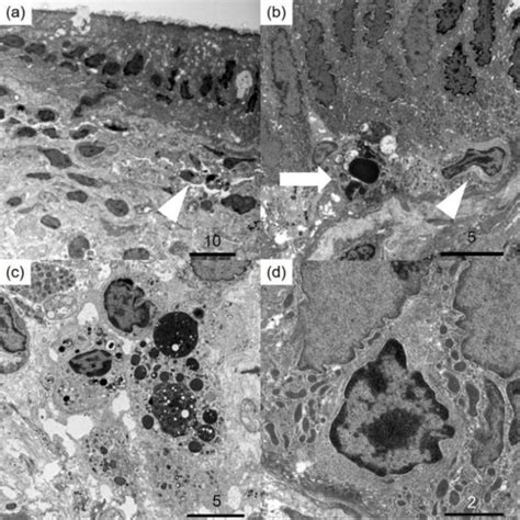 Histological Features Of Microscopic Colitis A Collagenous Colitis Download Scientific
