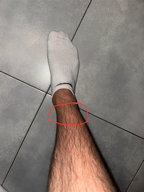 Oxelo Mf500 Lace Bite Ankle Pain Raskrollerblading