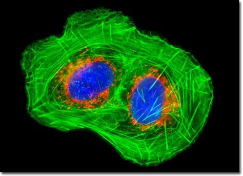 Molecular Expressions Microscopy Primer Specialized Microscopy