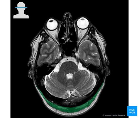 Mastoid Process Anatomy Function And Attachments Kenhub