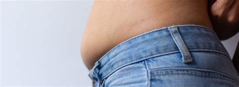 Stomach Bloating Causes Symptoms And Relief Circle Urgent Care