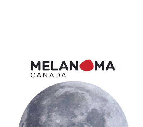 Melanoma Canada On Linkedin Detect Melanoma Learn How To Spot
