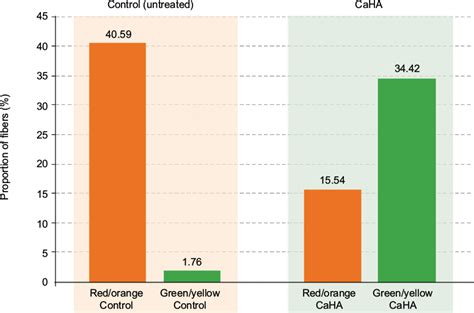 Calcium Hydroxylapatite Treatment Of Human Skin Evidence Of Collagen