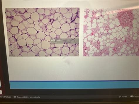 Lab Exam Flashcards Quizlet