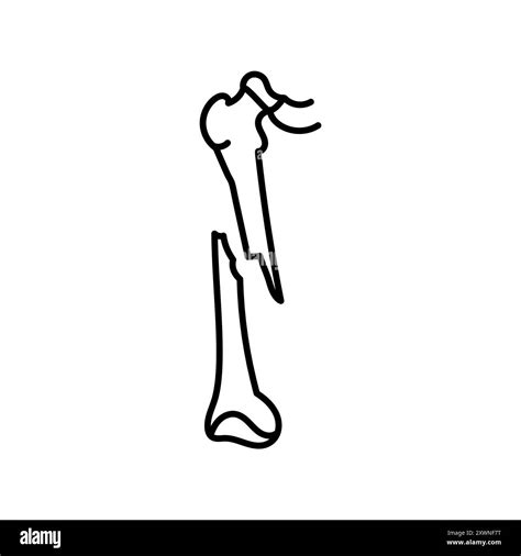 Femoral Fracture Line Black Icon Sign For Web Page Mobile App Button Logo Vector Isolated