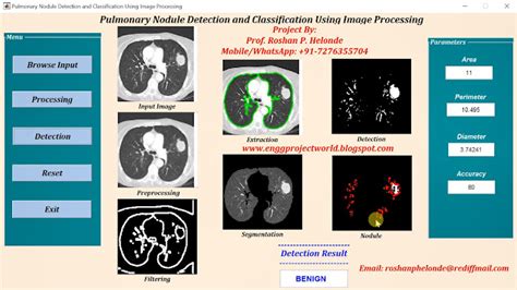 lung nodule detection using image processing matlab project with source