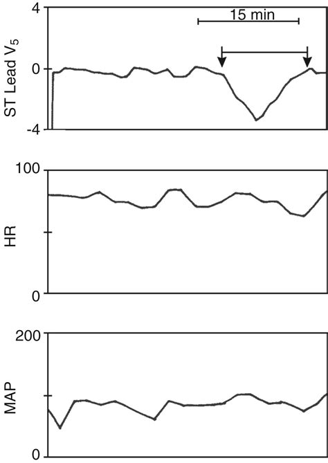 cardiovascular monitoring clinical tree