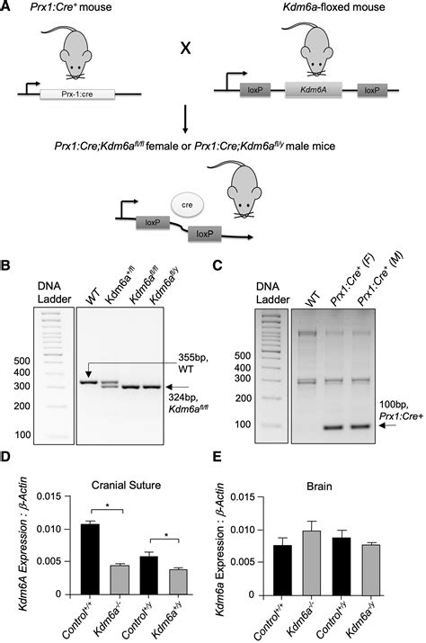 Kdm6a Mediated Regulation Of Cranial Frontal Bone Suture Fusion In Mice Is Sex Dependent Stem