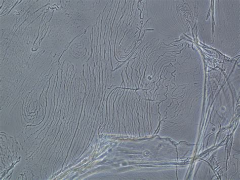 Have You Ever Encountered Thread Like Structures With This Morphology In Your Cell Cultures
