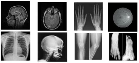 Figure 1 From Lossless Compression Methods For Real Time Images