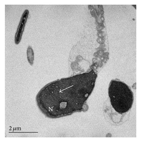 A B C And D Spermatozoa From Normal Sperm Samples With