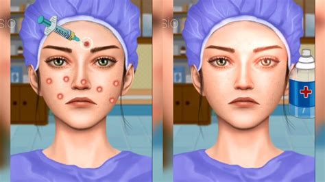 Asmr Pimple Removal Animation Laser Treatment Asmr Youtube