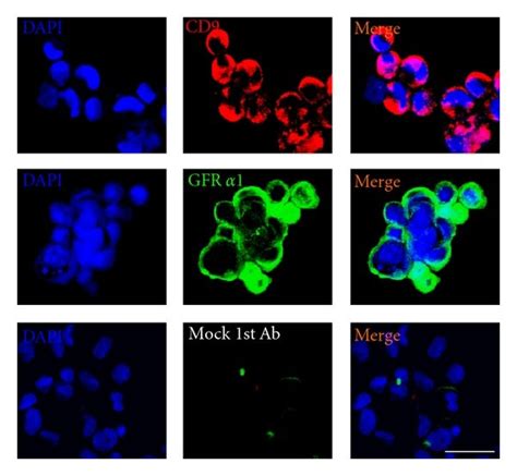Characterization Of Spermatogonial Stem Cells SSCs A Expression Of