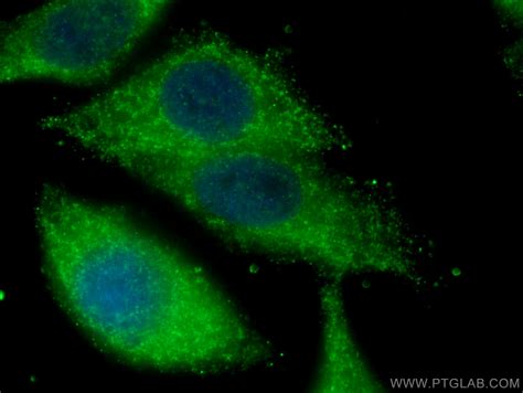 Pparg Fusion Protein Ag16657 Proteintech 武汉三鹰生物技术有限公司