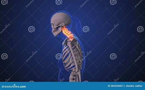Neck Pain Or Neck Dysfunction Or Cervical Posture Syndrome Stock Illustration Illustration Of