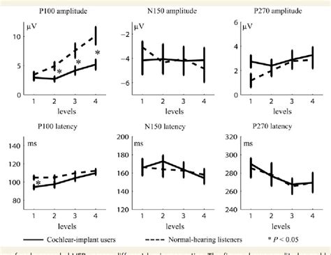 Figure 3 From Visual Activation Of Auditory Cortex Reflects Maladaptive