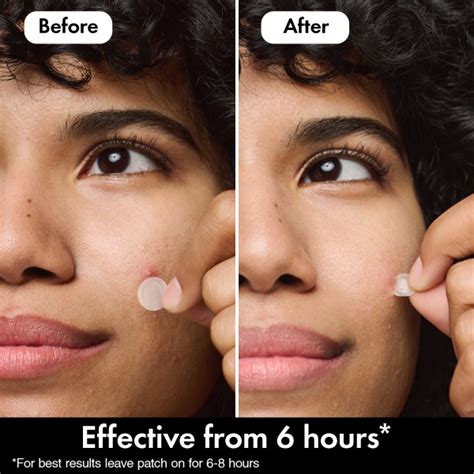 Hero Mighty Patch Mini Invisible Pimple And Acne Patches 30ct Skin Superdrug