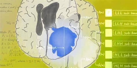 Artificial Intelligence Enhances Brain Tumor Diagnosis Axis Imaging News