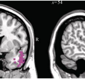 Introduction To Semantics PPT Semantic Technologies
