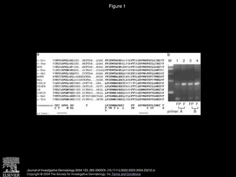 Expression Profiles Of Tyrosine Kinases In Cultured Follicular Papilla