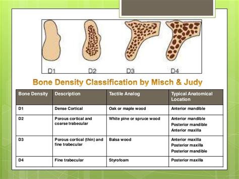 Radiographic Imaging For Dental Implant Assessment